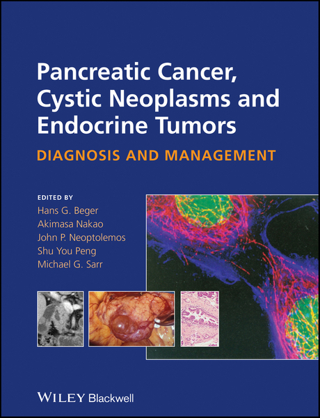 Pancreatic Cancer, Cystic Neoplasms and Endocrine Tumors – DC eBOOKS