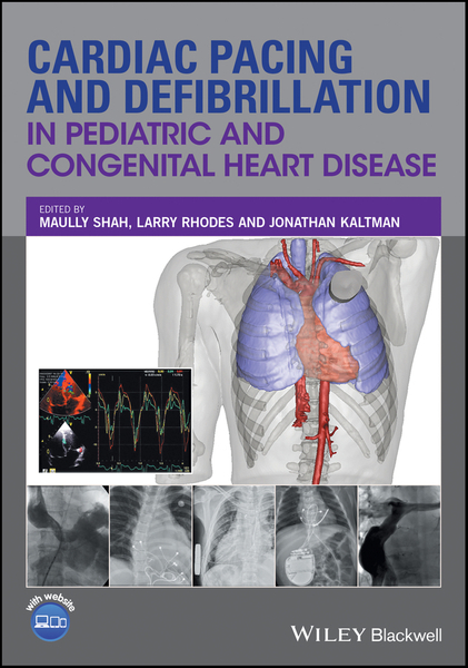 Cardiac Pacing and Defibrillation in Pediatric and Congenital Heart ...