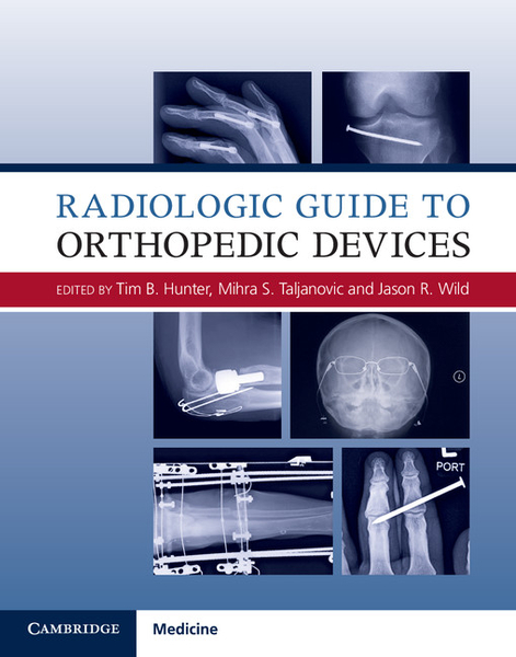 Radiologic Guide to Orthopedic Devices – DC eBOOKS